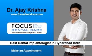 Dr. Ajay Krishna : Best Dental Implantologist in Hyderabad