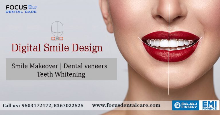 Smile Designing in Hyderabad | Focus Dental Care